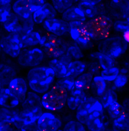 Chimera viruses can help the fight against lymphomas - iMM