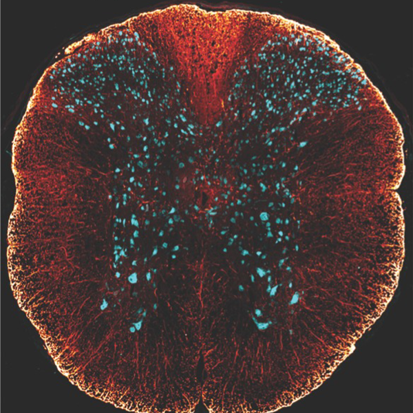 “Células zombies” contêm pistas para reparar lesões na medula espinhal ...